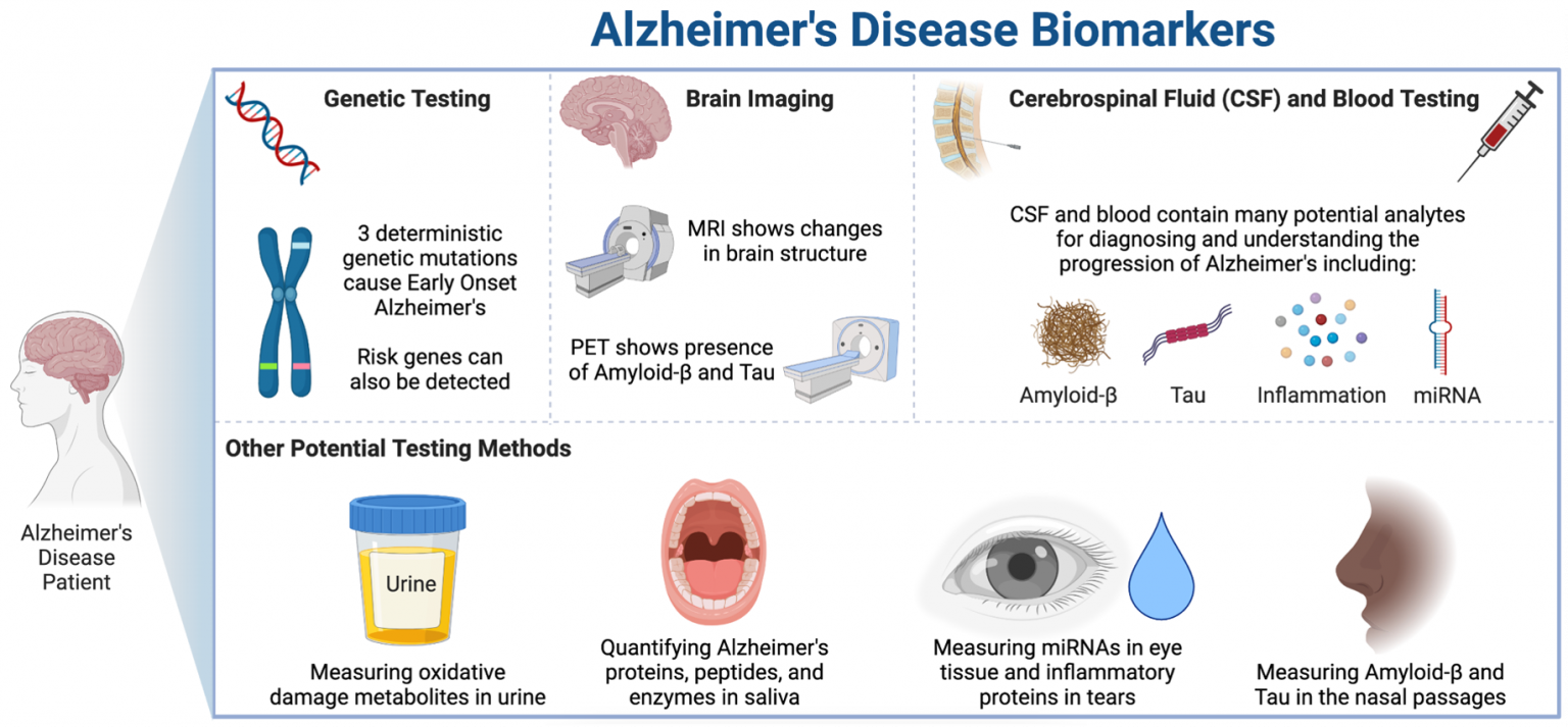 The Role of Biomarkers in Understanding Alzheimer’s Disease